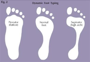 Kenali Jenis Kaki Sebelum Memilih dan Membeli Sepatu | iKurniawan